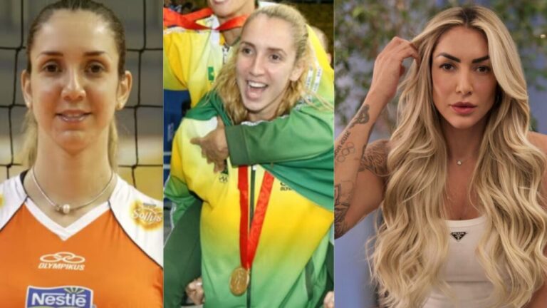 Antes e depois: veja por quais procedimentos Thaisa, do vôlei, passou